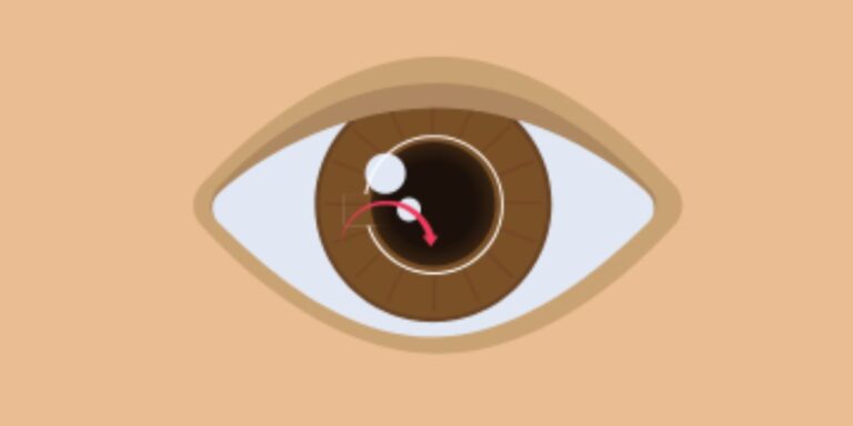 Conventional Lasik | The Lasik Surgery Clinic PH